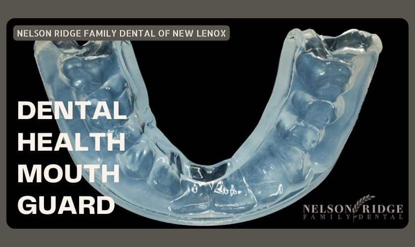 Maintain Teeth With Different Kinds Of Mouthguards